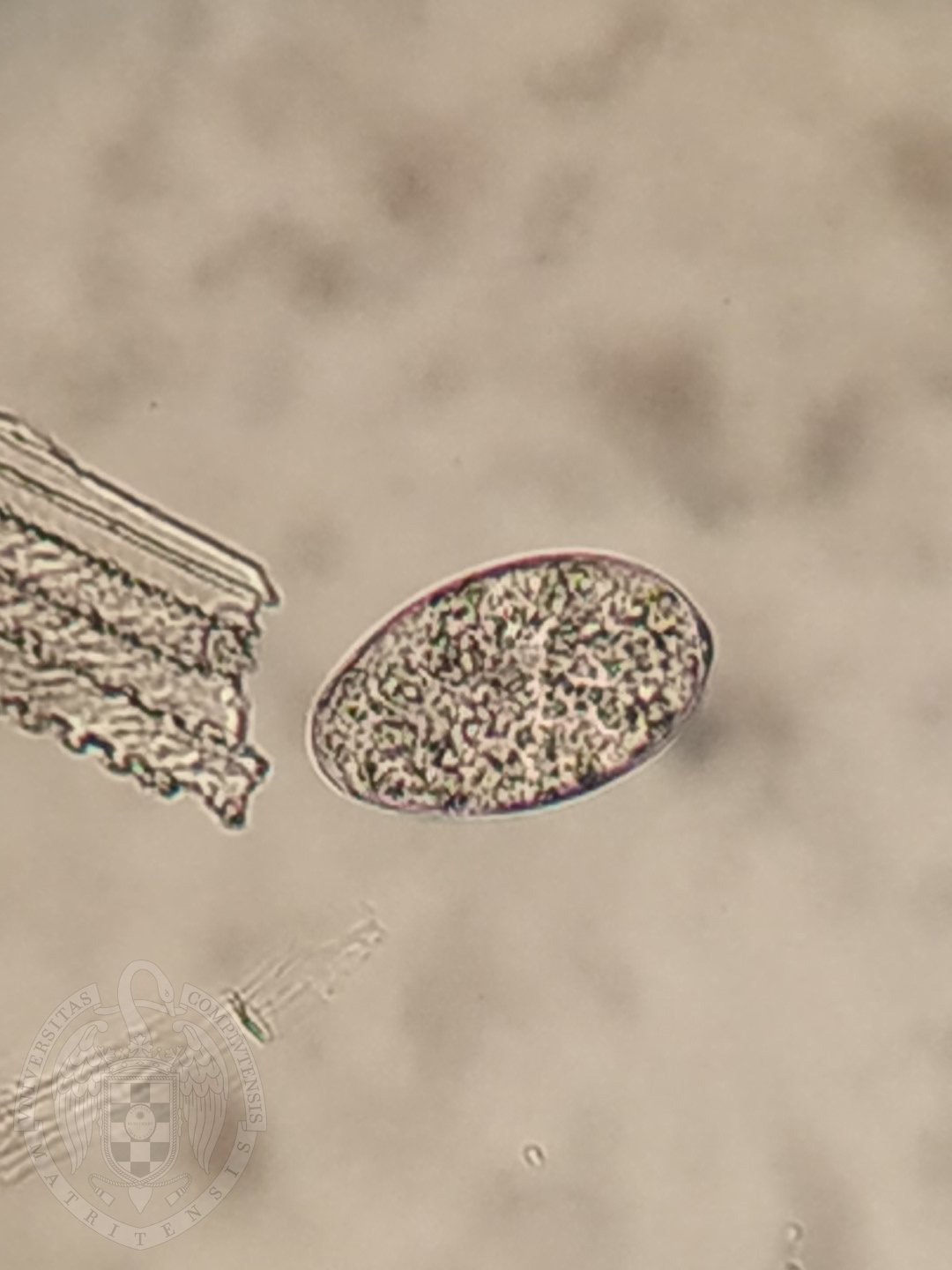 Calicophoron daubneyi