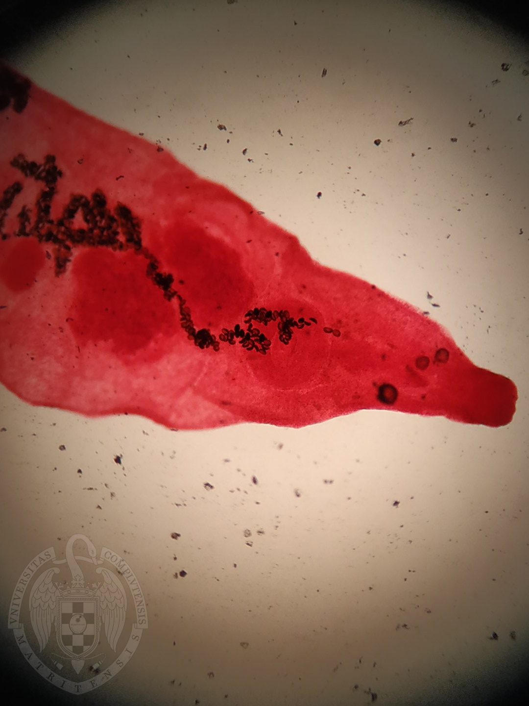 Dicrocoelium dendriticum