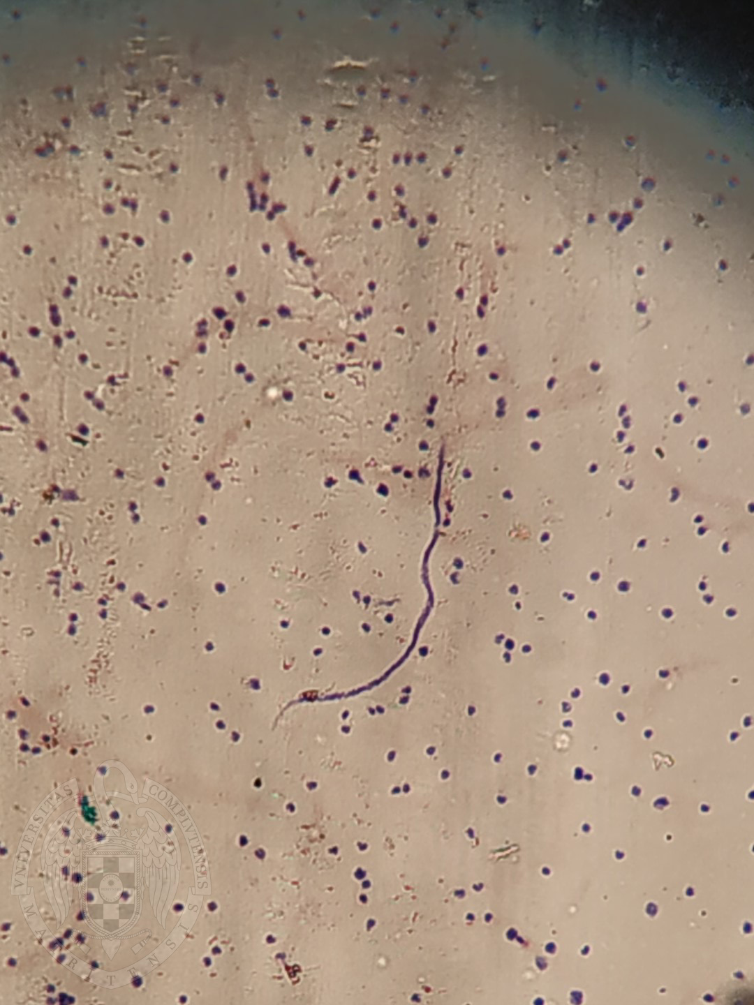 Dirofilaria Immitis Microfilariae