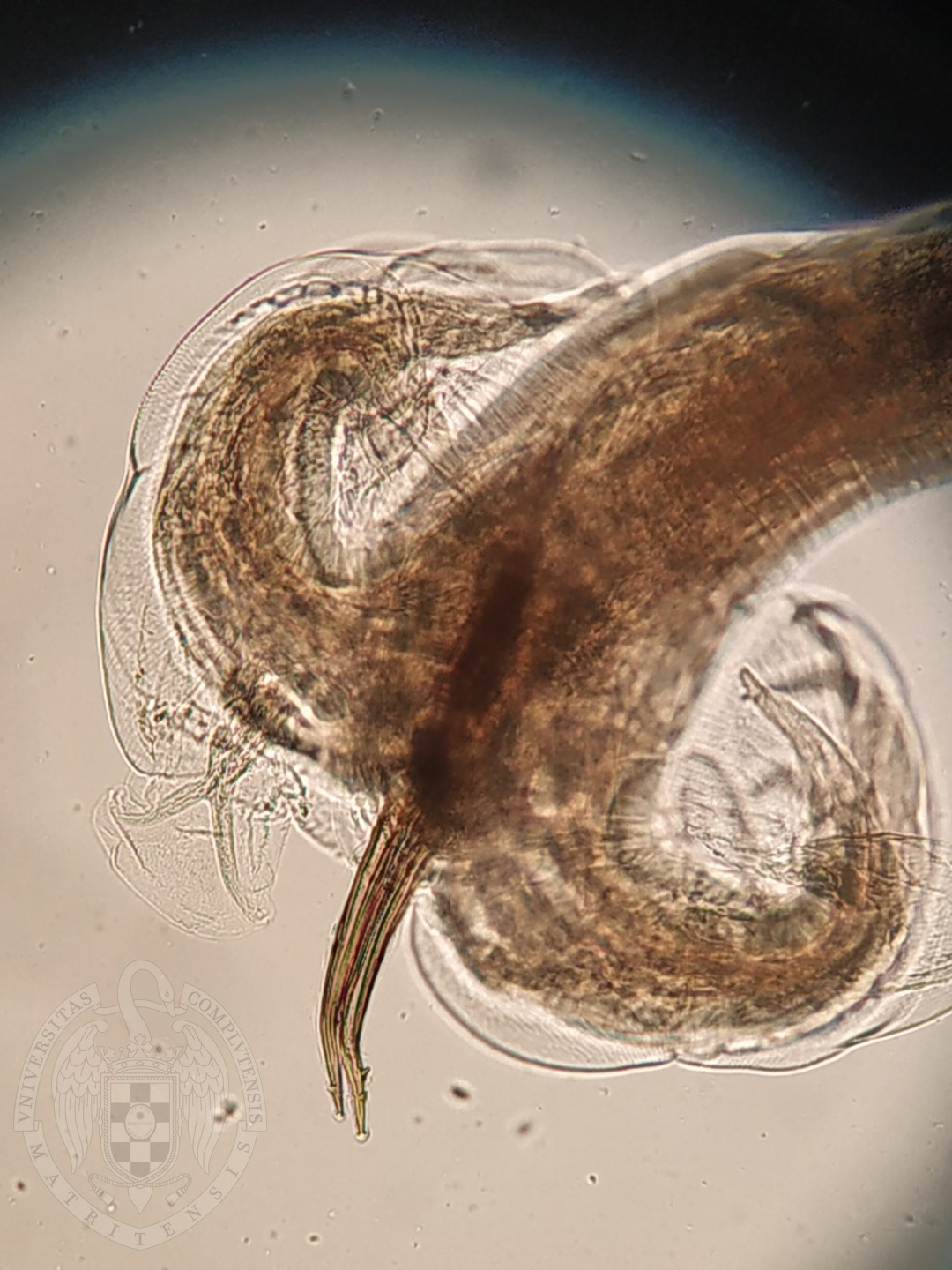 Haemonchus contortus