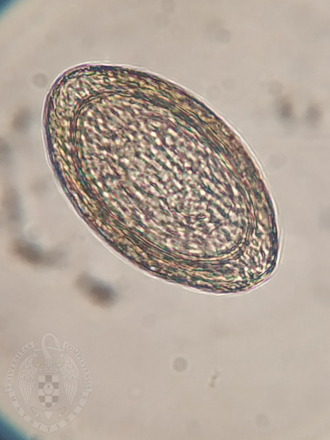 Macracanthorhynchus hirudinaceus